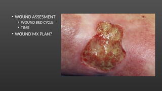 WOUND DRESSING presentation for cme 2018.pptx