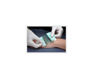 wound dressing with technique to solve them | PPTX