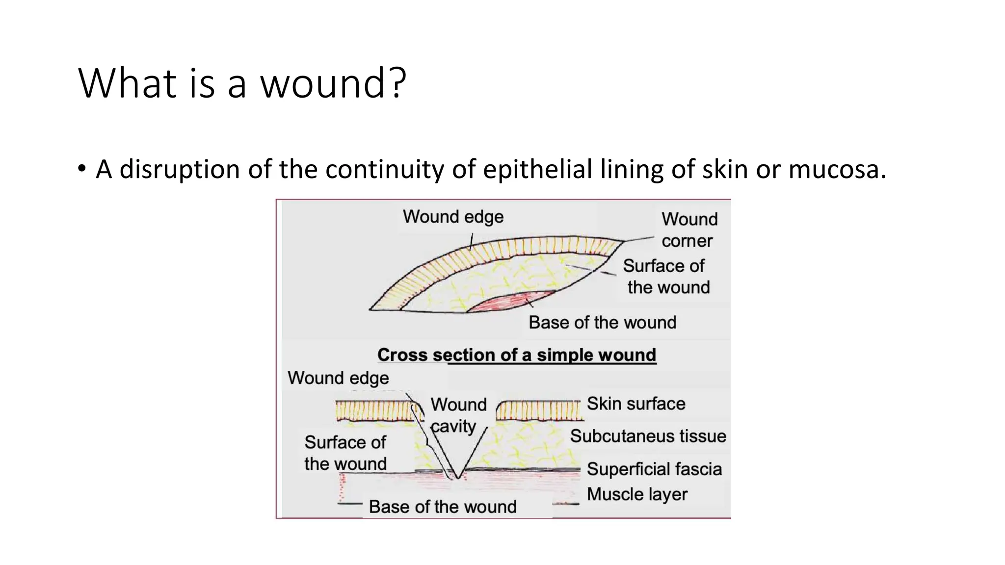 Wound dressings BSH.pptx