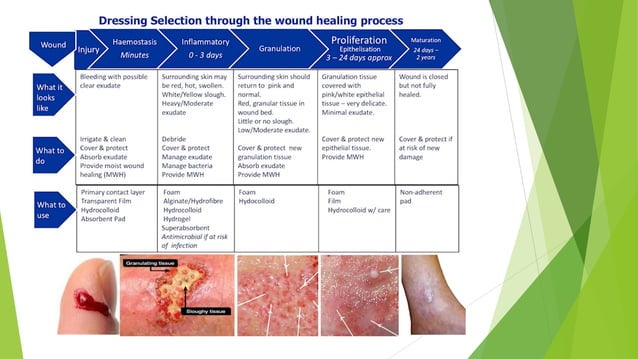 wound dressing selection.pdf | First Aid | Injuries