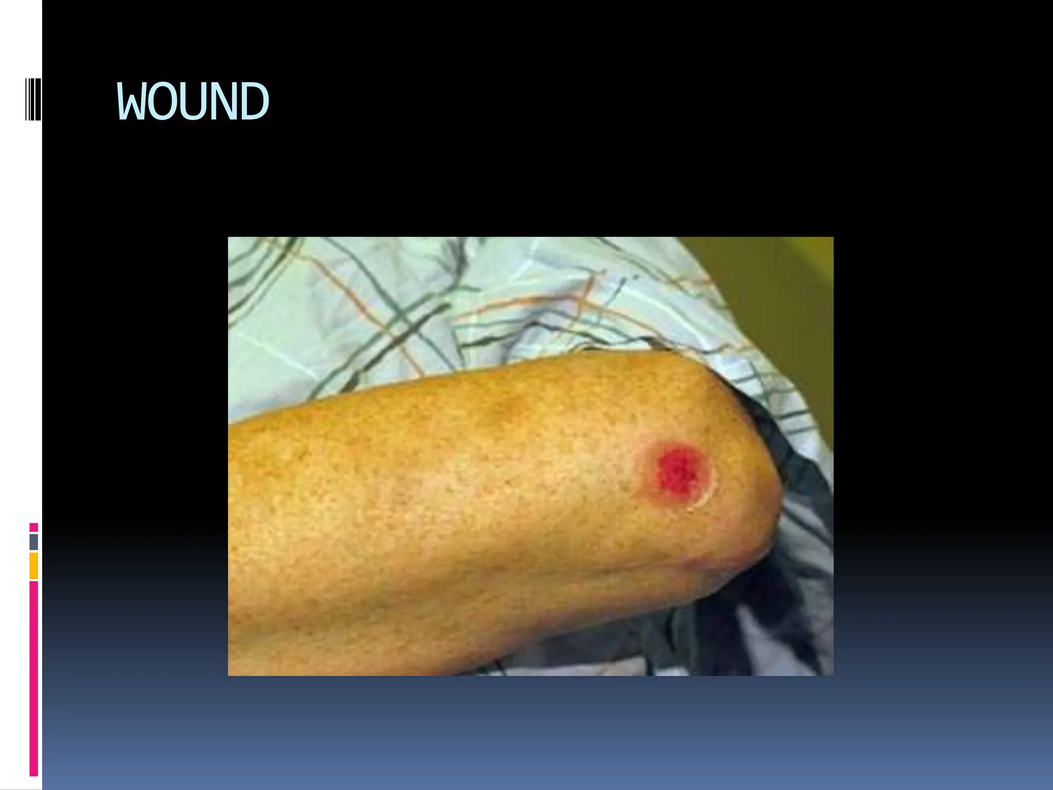 WOUND DRESSING STEPS AND TYPE WITH NURSES ROLE.ppt