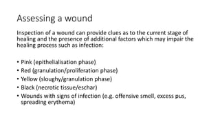 Wound Dressing Types By Doctor faarwqewqeqweqw | PPTX