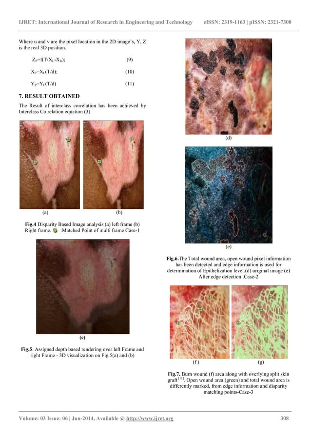 Wound epithelization model by 3 d imaging | PDF