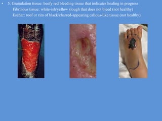 WOund evaluation and preparatioacfoeding to the medicinen.pptx