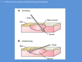 Wound Evaluation And Preparatioacfoeding To The Medicinen.pptx