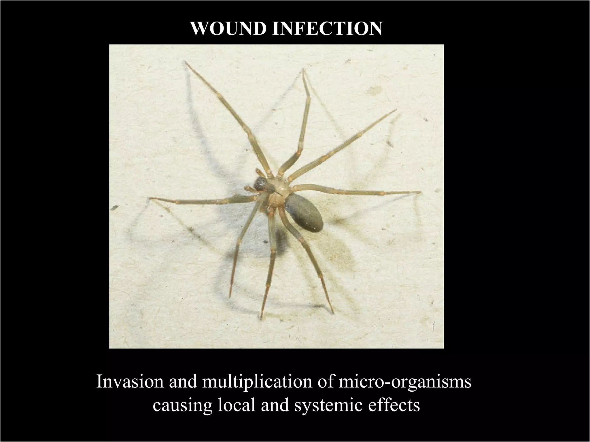 Wound field concept ad | PPT