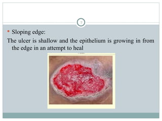 wound and wound healinh for the medical students | PPT