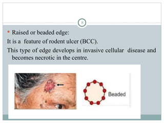 wound and wound healinh for the medical students | PPT