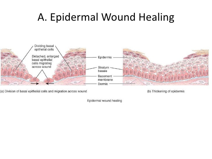Wound healing