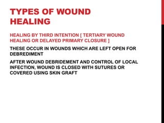 Wound healing | PPTX