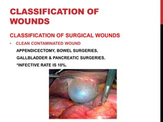 Wound healing | PPTX
