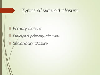 Wound healing | PPT