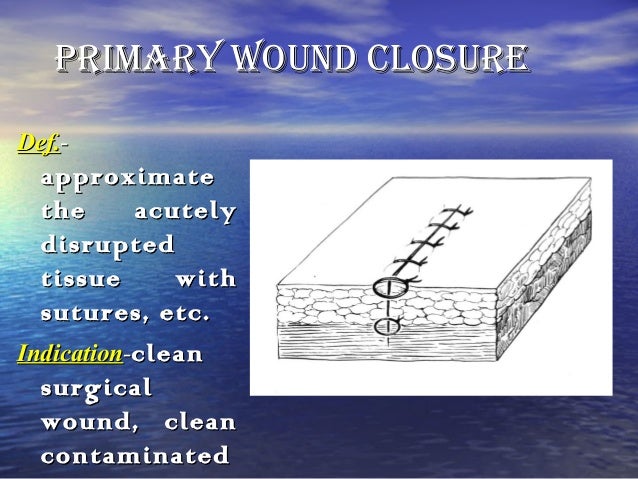 Wound healing