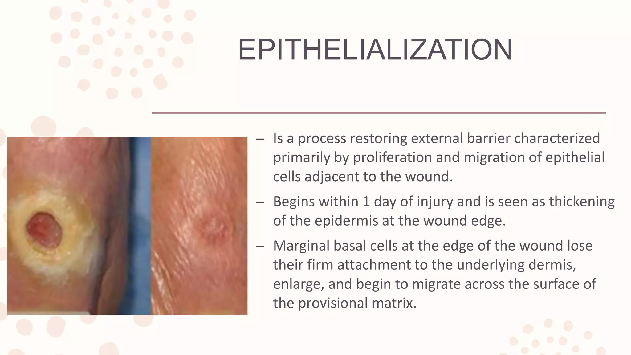 Wound healing | PPTX