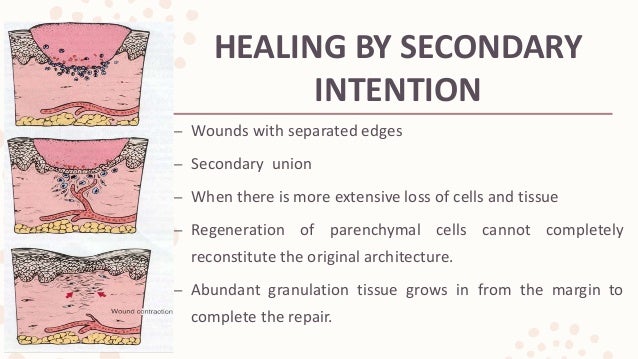 Wound healing