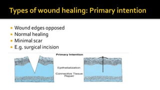 Wound healing | PPTX
