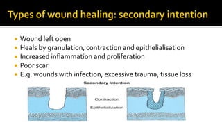 Wound healing | PPTX