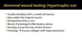 Wound healing | PPTX