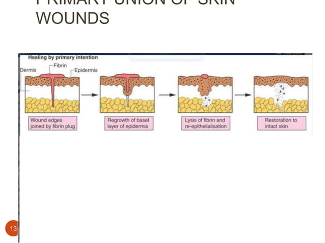 Wound healing | PPT