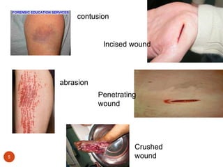 Wound healing | PPTX