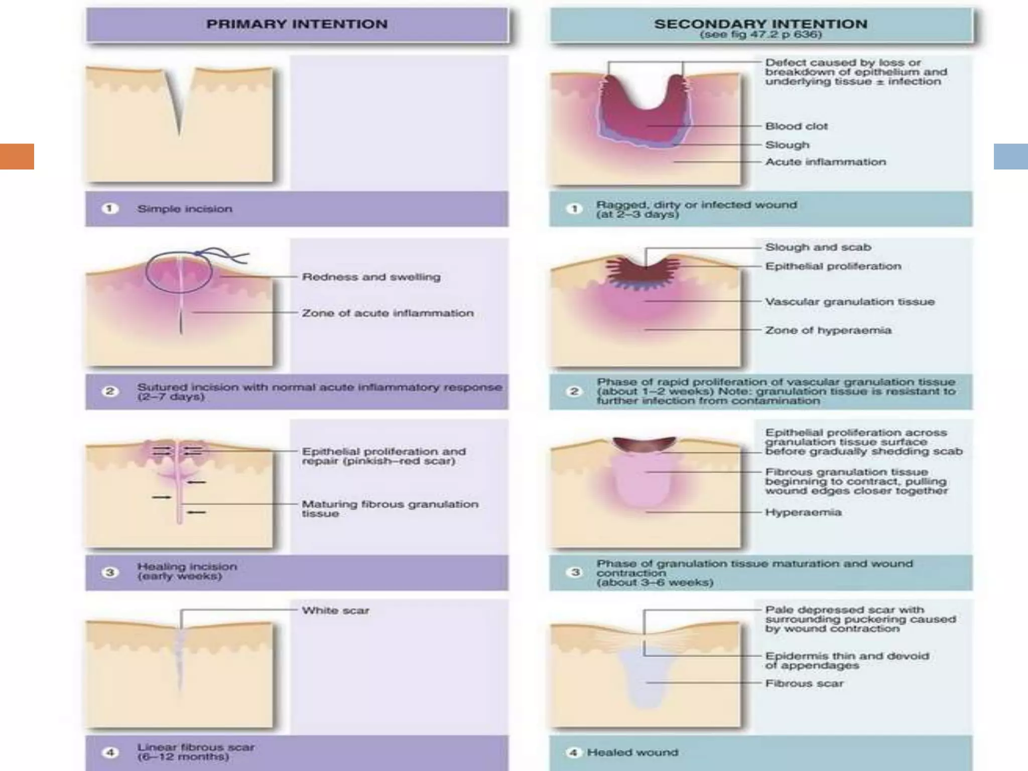 Wound healing | PPT