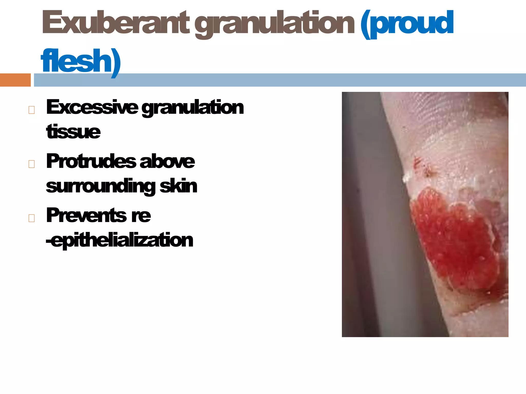 woundhealing-190112152216.pptx