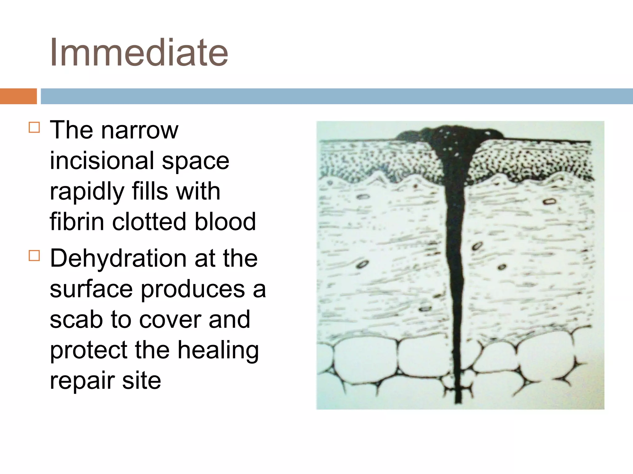 Wound healing | PPT