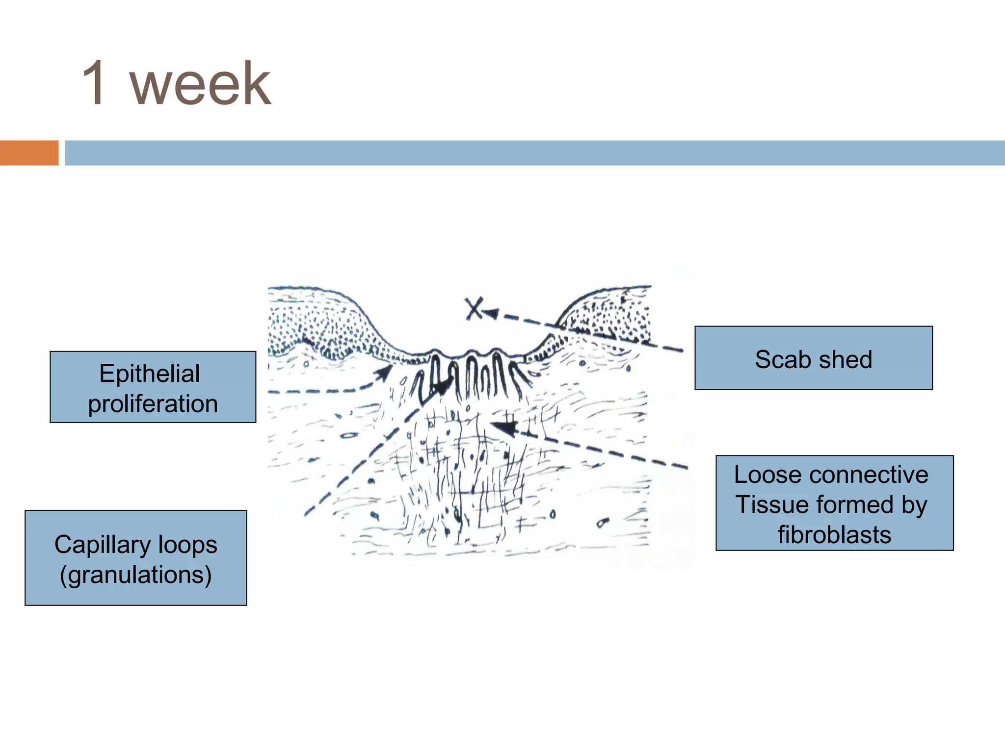 Wound healing | PPT