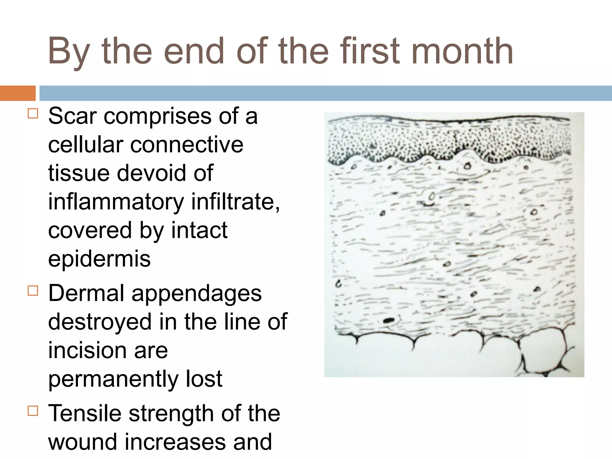 woundhealing-190112152216 (1).pdf