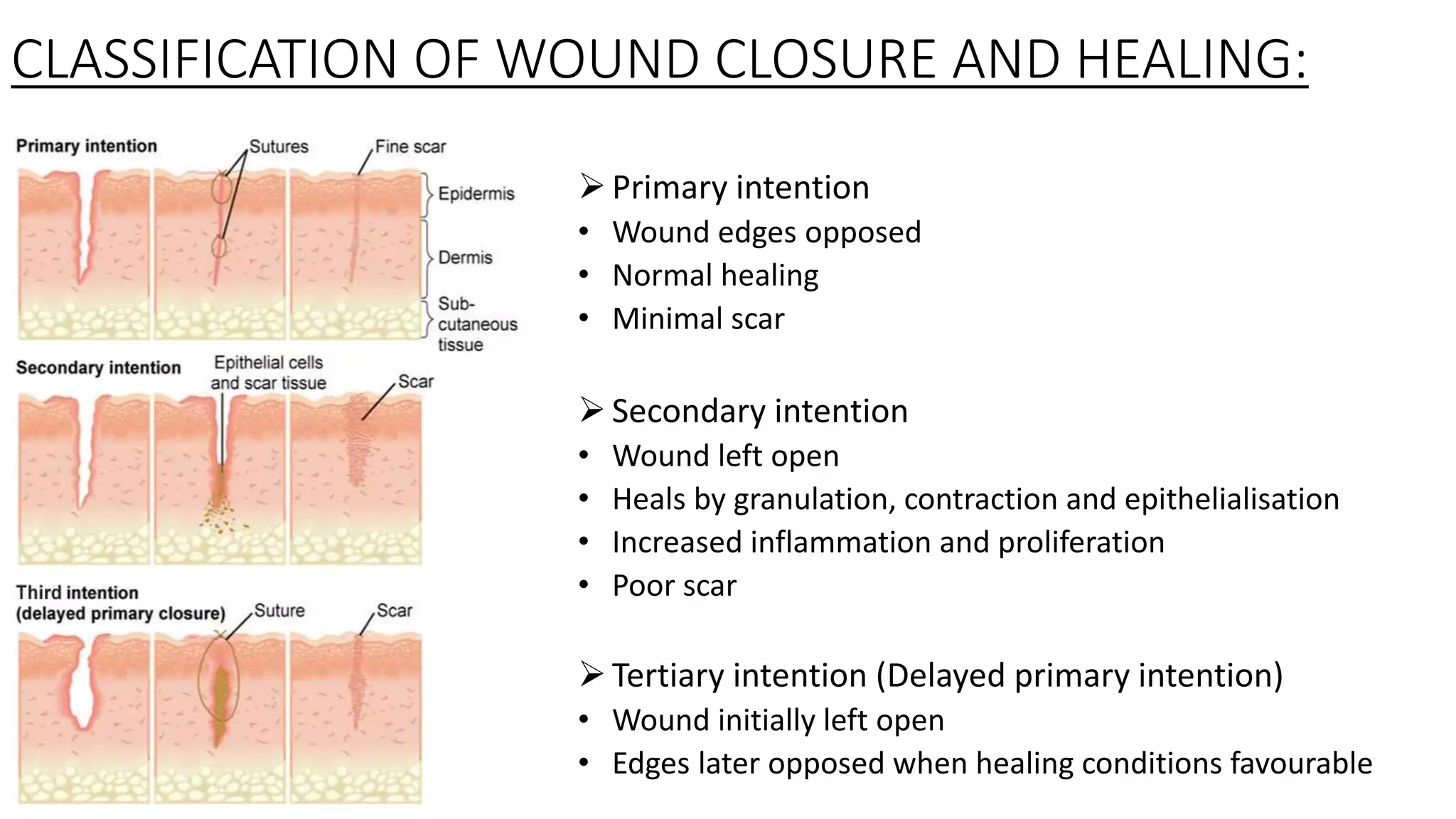 Wound healing | PPTX