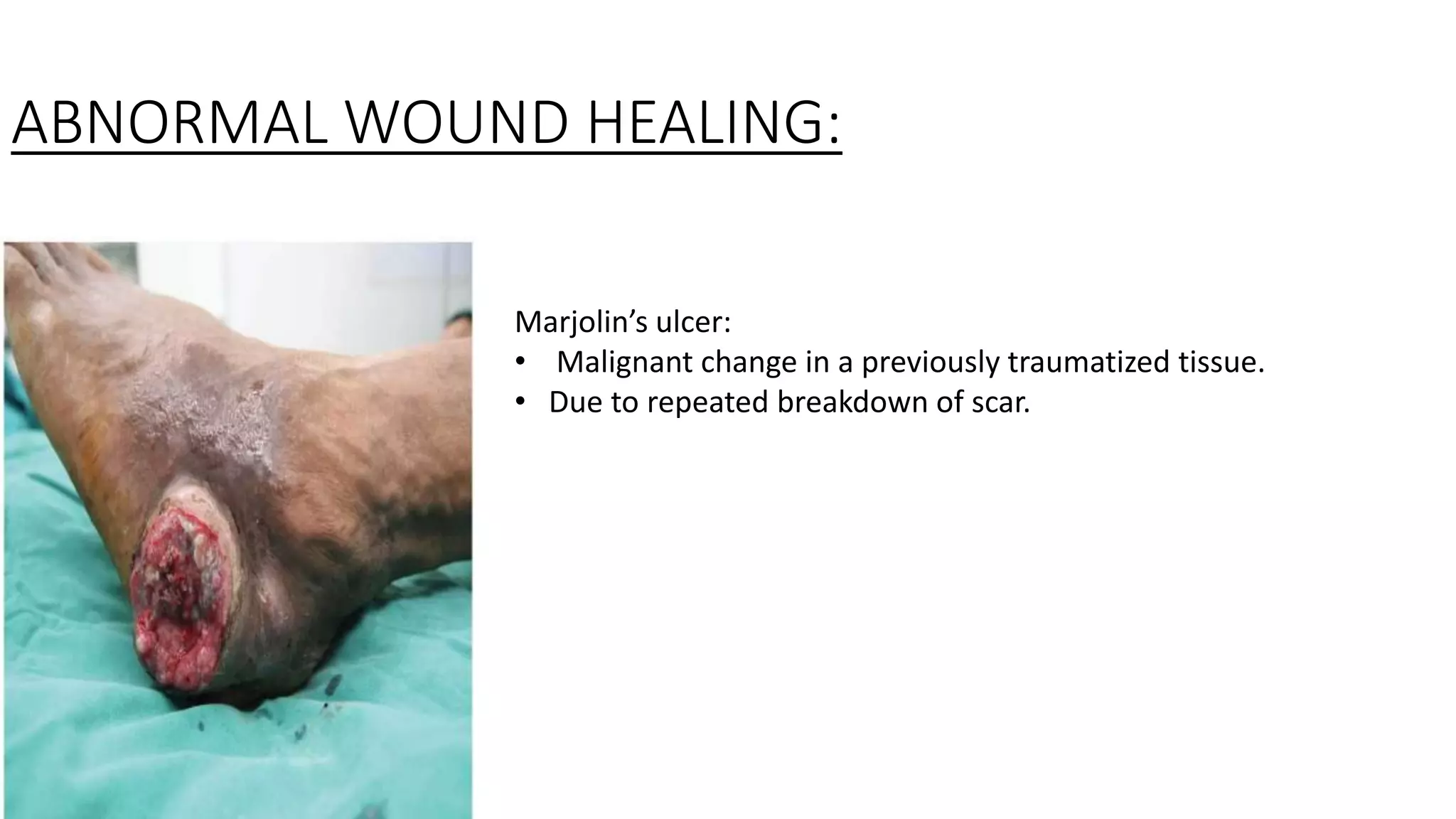 Wound healing | PPTX