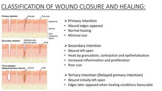 Wound healing | PPTX