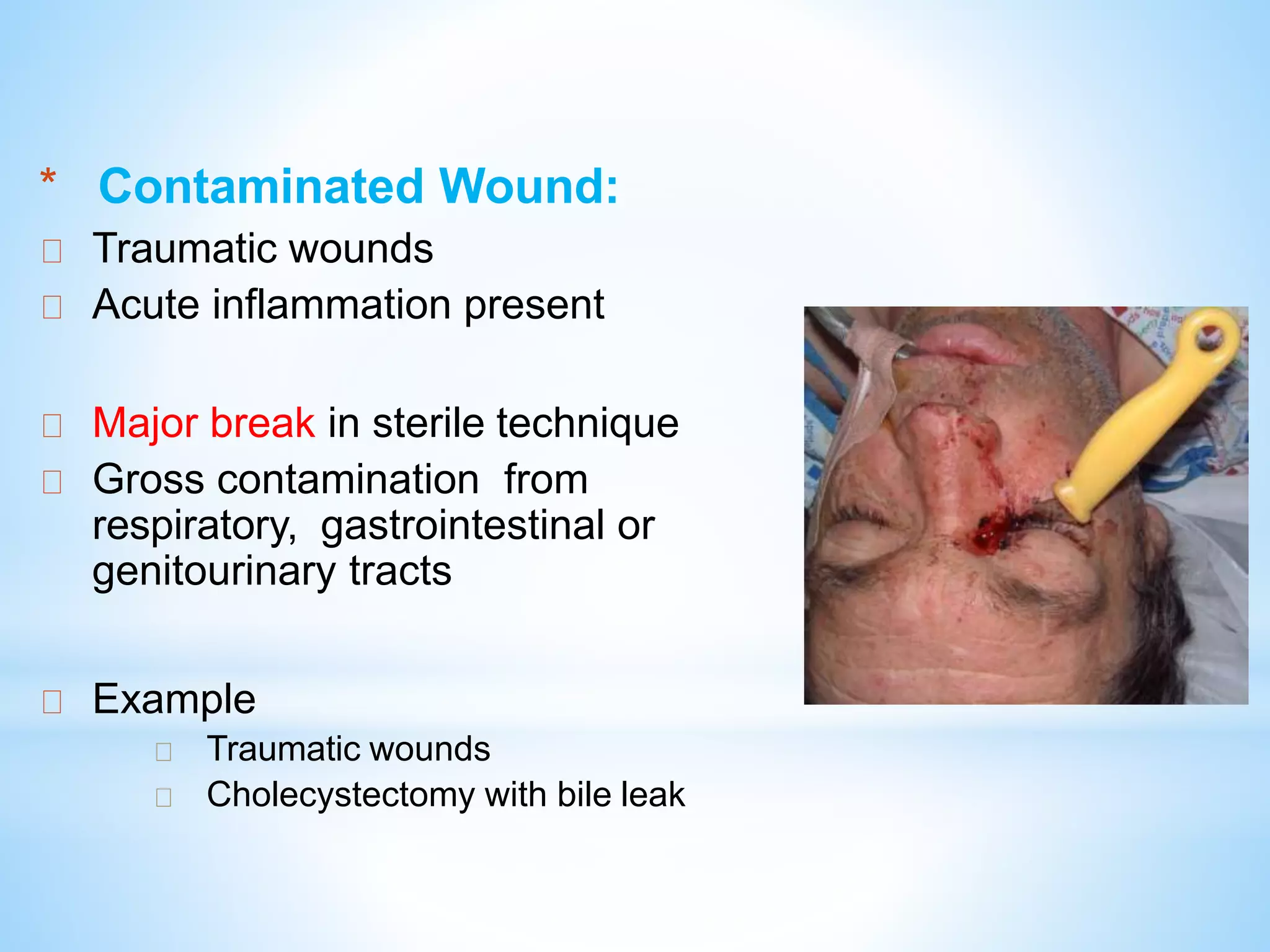 Wound healing | PPTX
