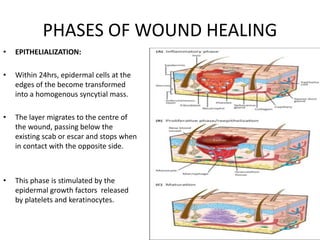 Wound healing | PPT