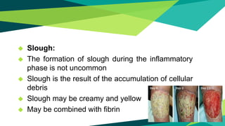 Wound healing | PPTX