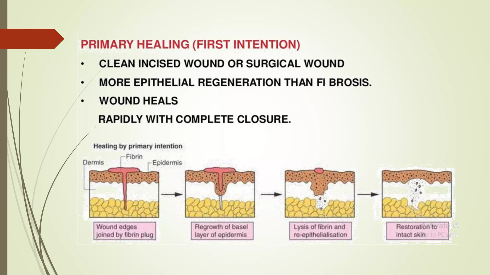 Wound healing | PPTX