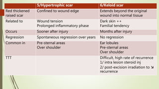 Wound healing | PPT