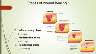 Wound healing | PPT