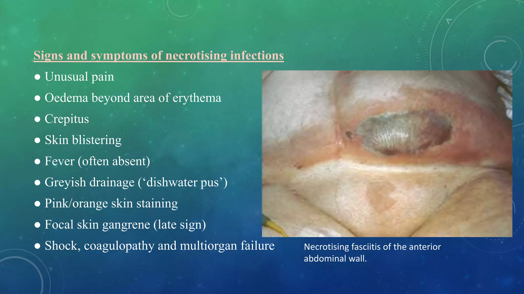 Wound healing | PPTX