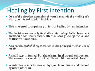 Wound healing | PPTX