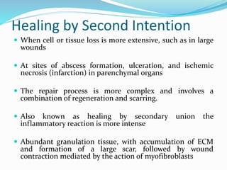 Wound healing | PPTX