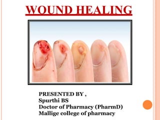 woundhealing bacteria inflammation and repair | PPT