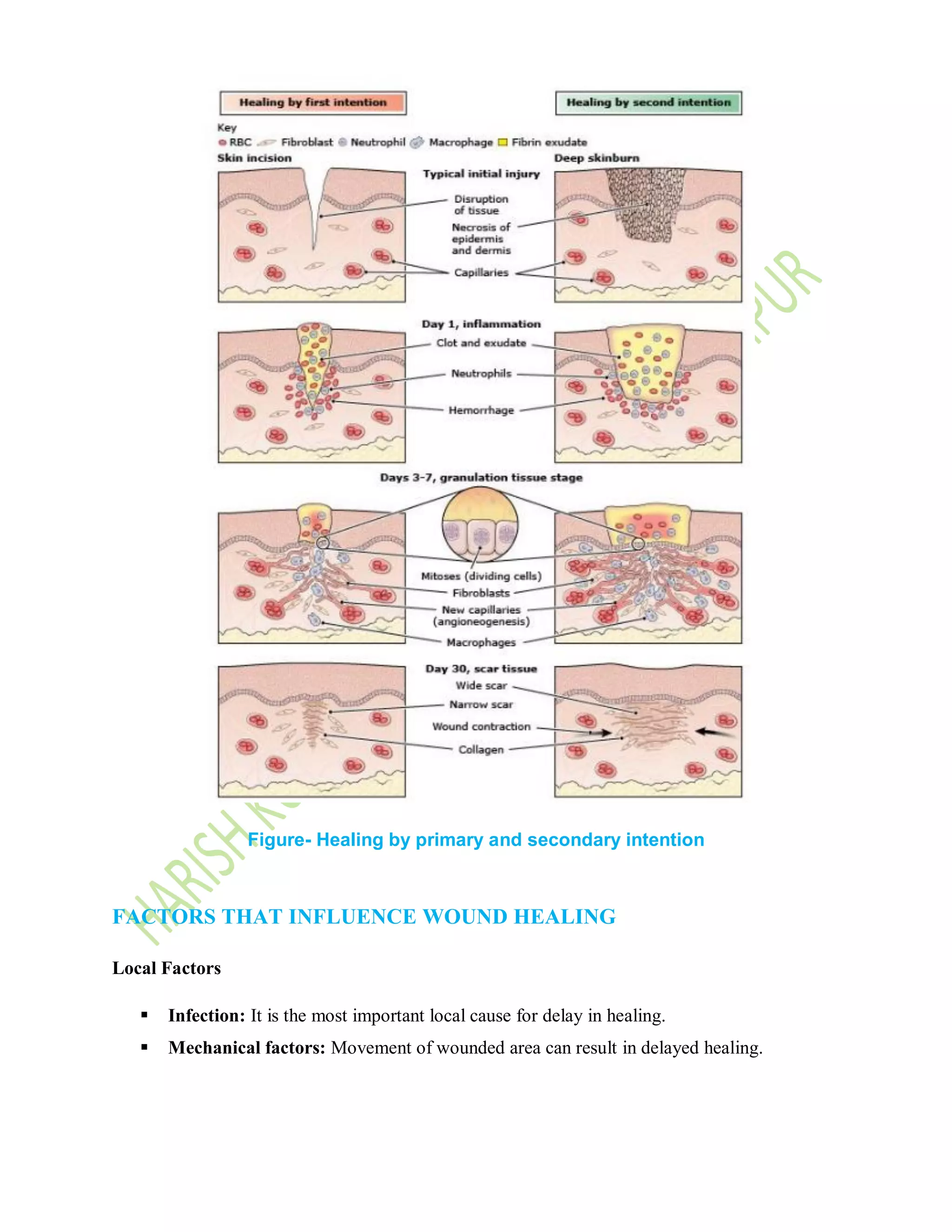 Wound healing | PDF