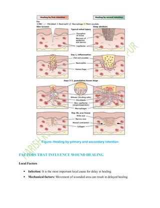 Wound healing | PDF