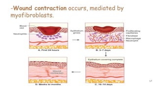 Wound healing | PPTX