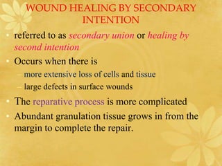 Wound healing | PPTX