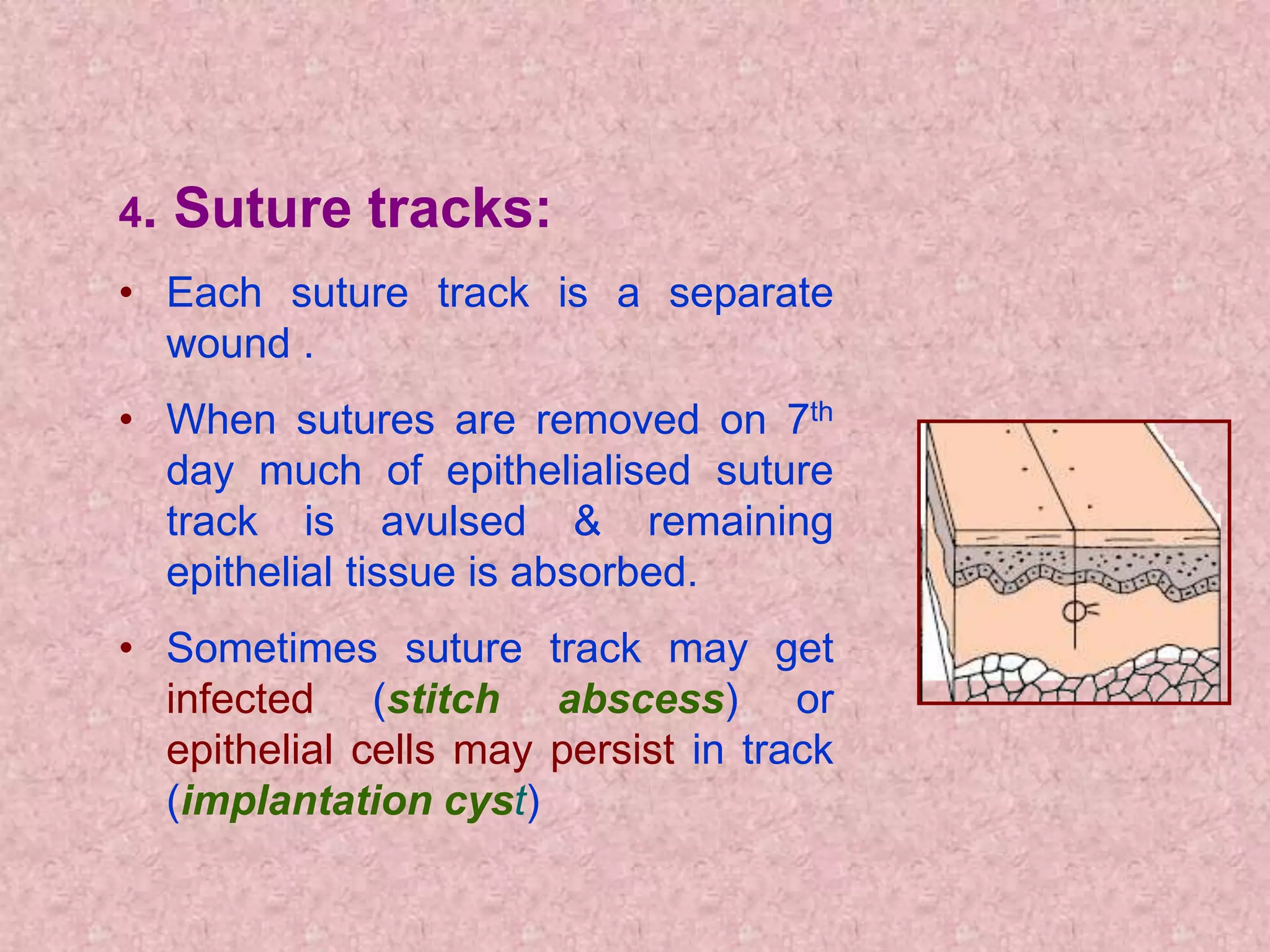 WOUND HEALING.ppt