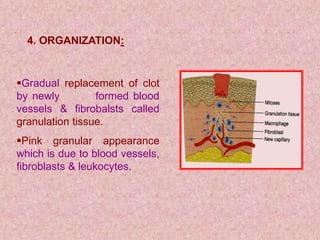 WOUND HEALING.ppt