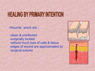 Wound Healing Primary Intention