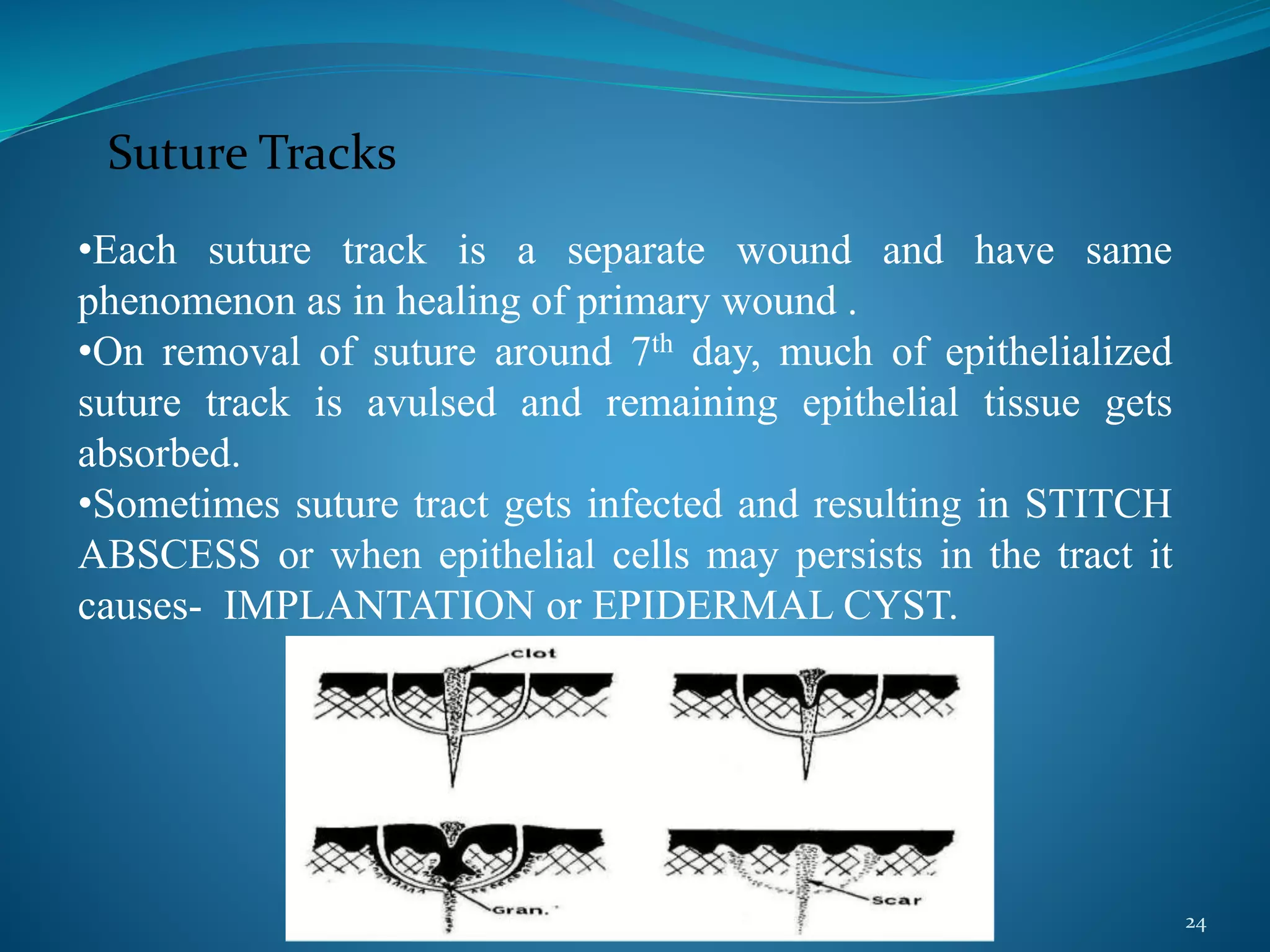WOUND HEALING.pptx